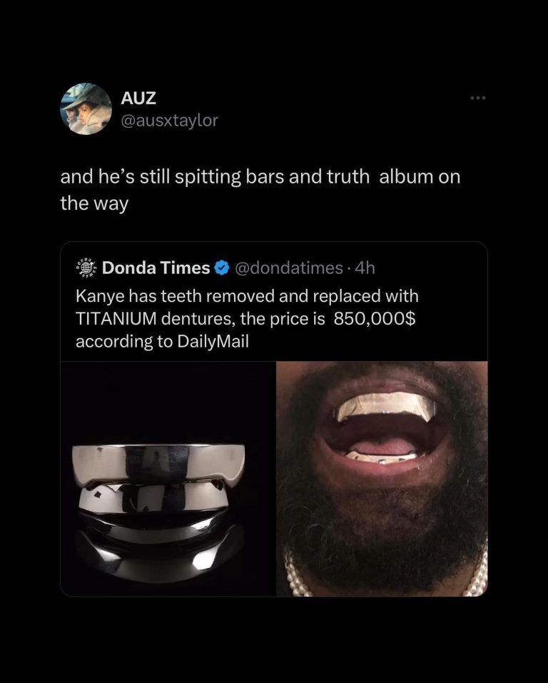 Kanye West Teeth: The Shocking Transformation Revealed - CEOColumn