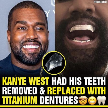 Kanye West Teeth: The Shocking Transformation Revealed - CEOColumn